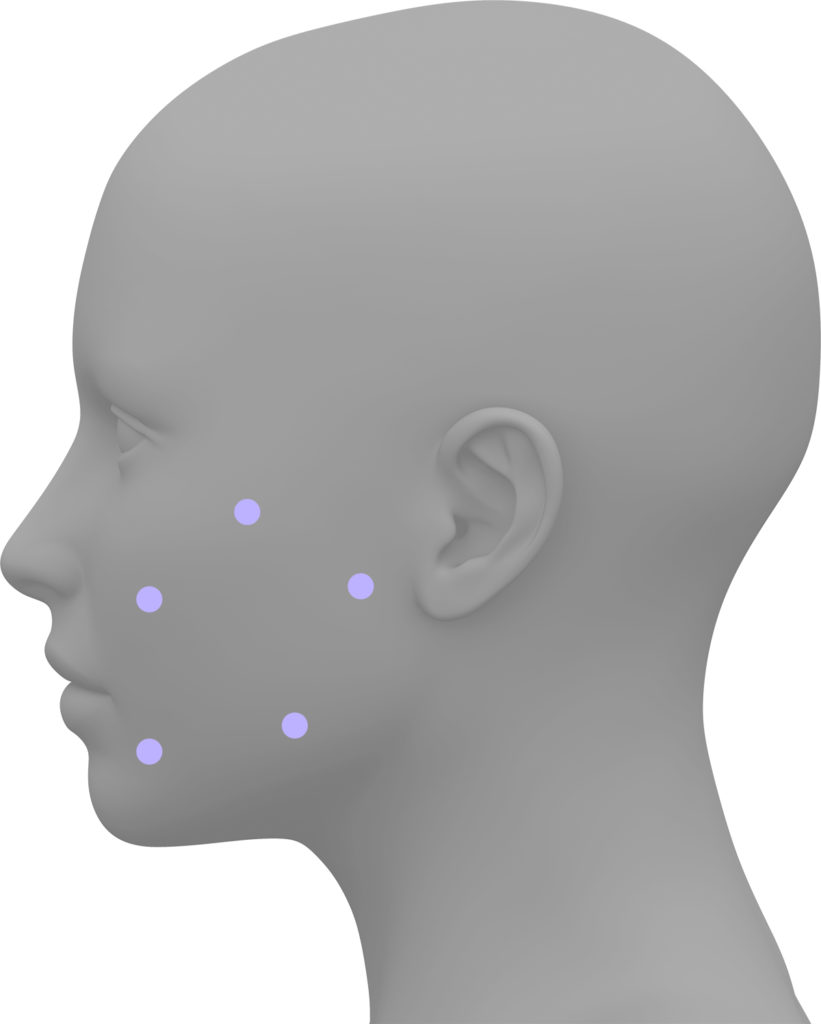 PROFHILO® - AssureHealth Group